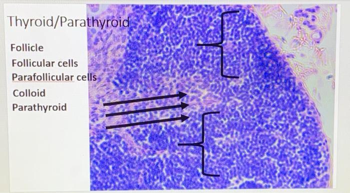 Thyroid Gland Slide Labeled Parafollicular Cells