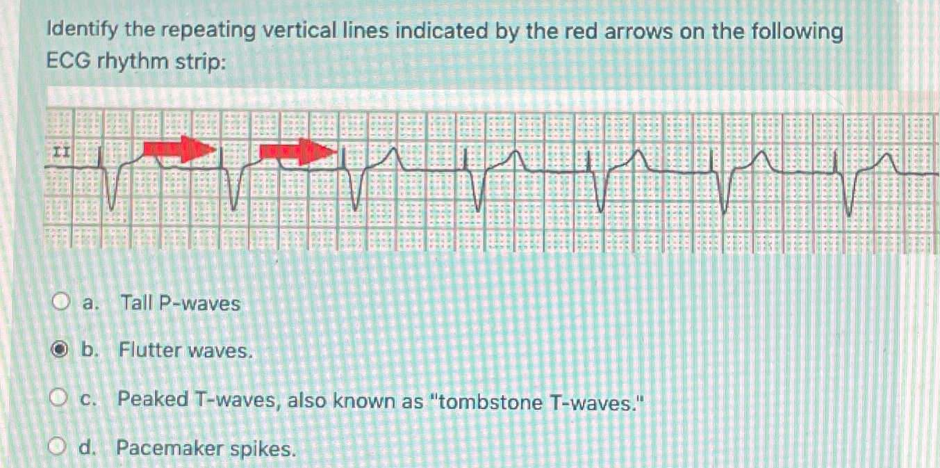 Solved Identify the repeating vertical lines indicated by | Chegg.com