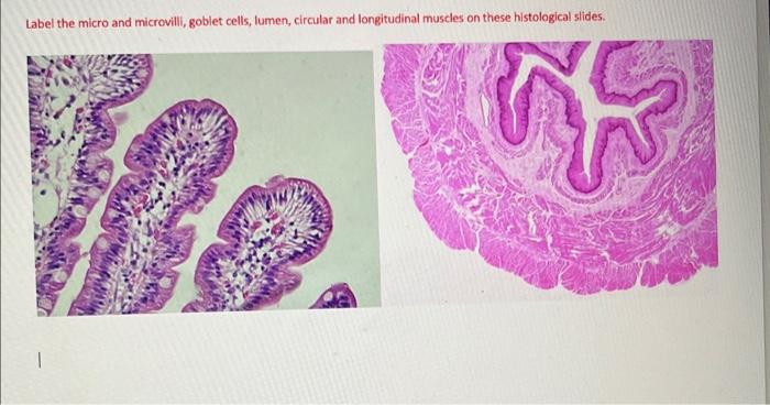 Solved Label the micro and microvilli, goblet cells, lumen, | Chegg.com
