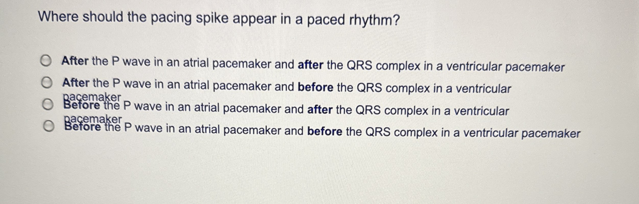 Where should the pacing spike appear in a paced | Chegg.com