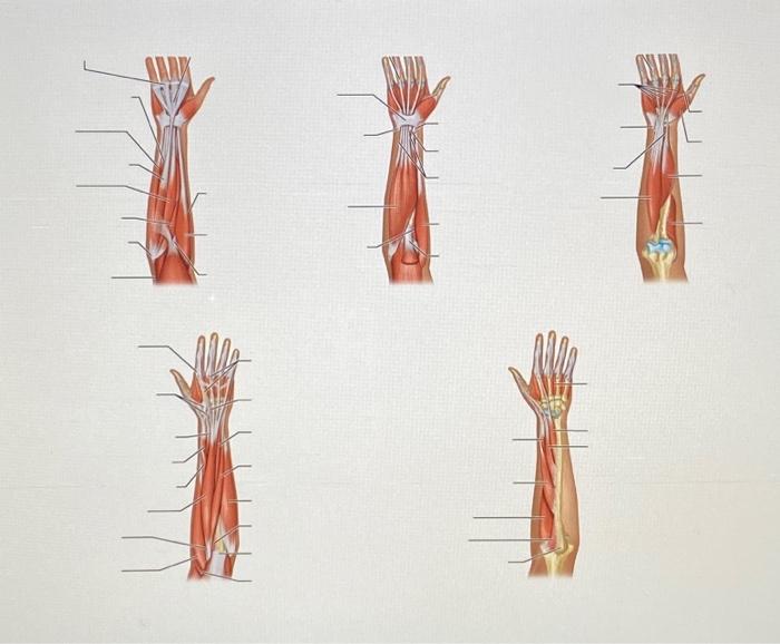 label the following muscle on the pictures of the | Chegg.com