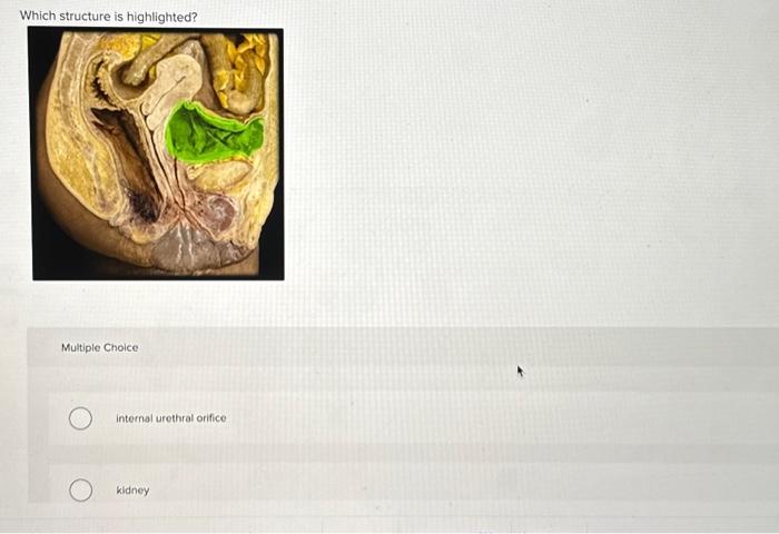 Solved Which structure is highlighted? Multiple Choice | Chegg.com