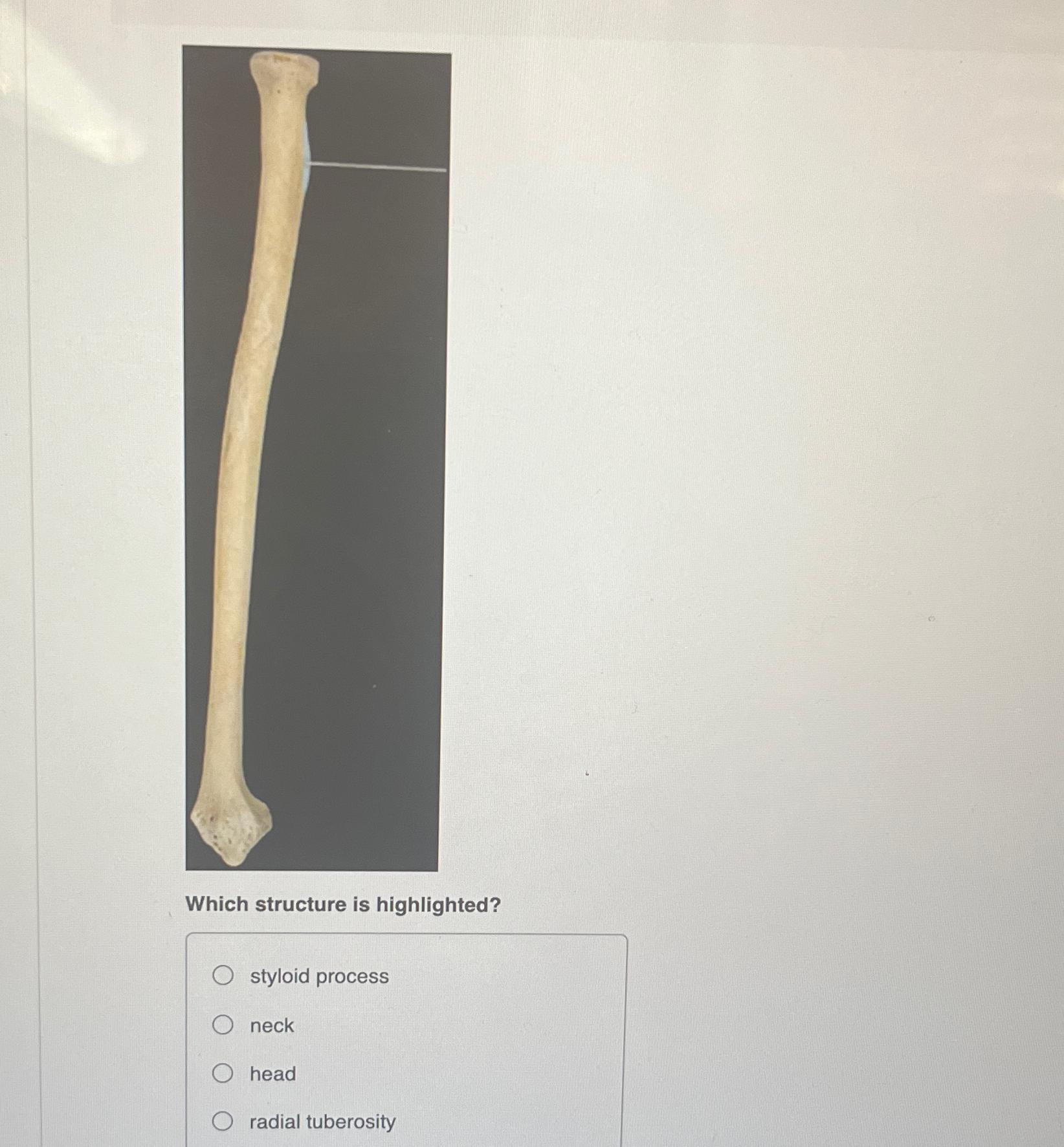 Solved Which structure is highlighted?styloid | Chegg.com