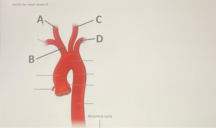 Solved Identify the vessel labeled B. | Chegg.com