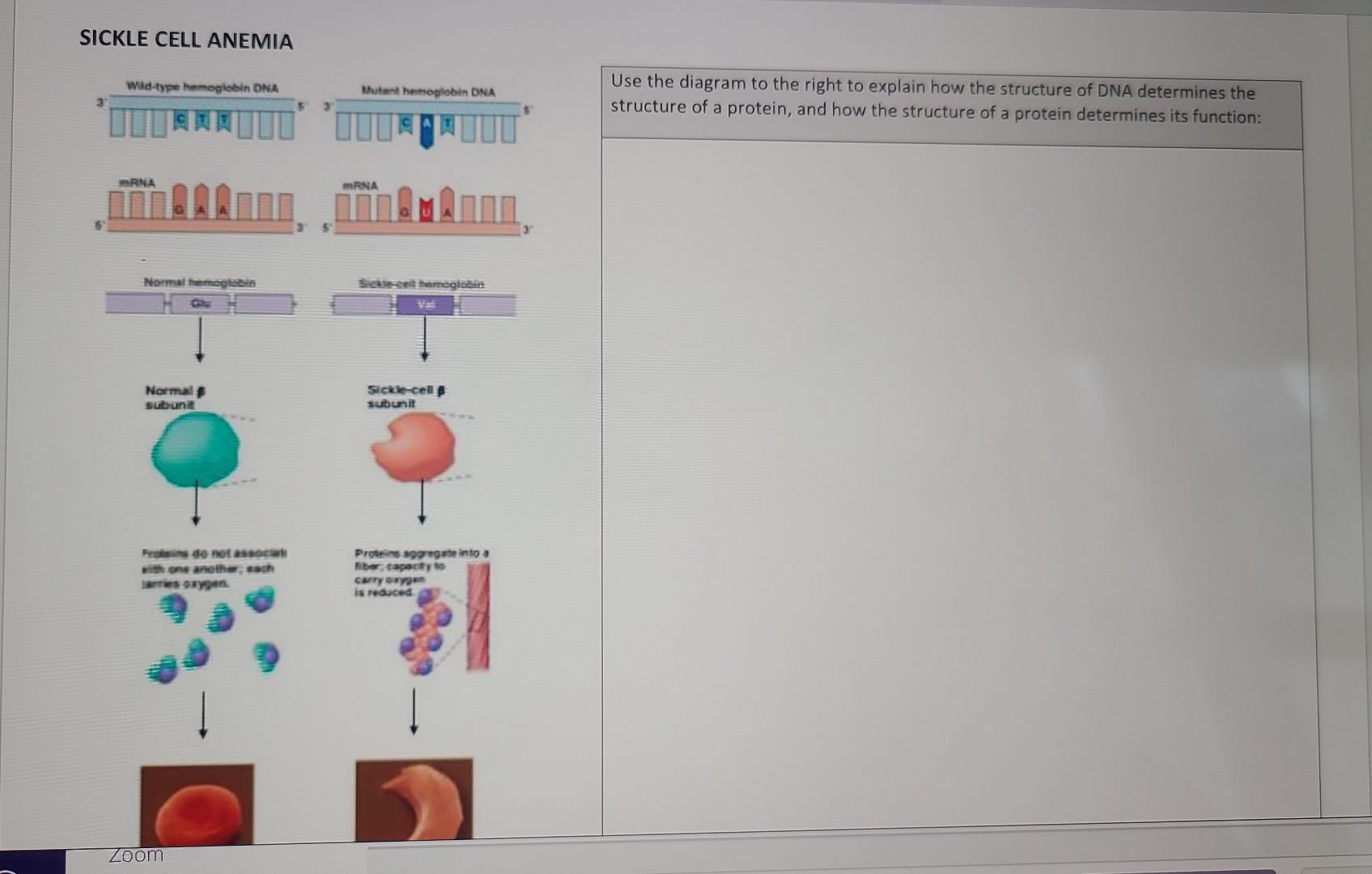 Solved SICKLE CELL ANEMIA Use the diagram to the right to | Chegg.com