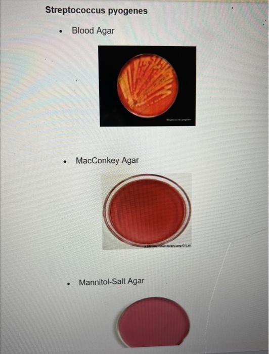 Solved Streptococcus pyogenes - Blood Agar - MacConkey Agar | Chegg.com