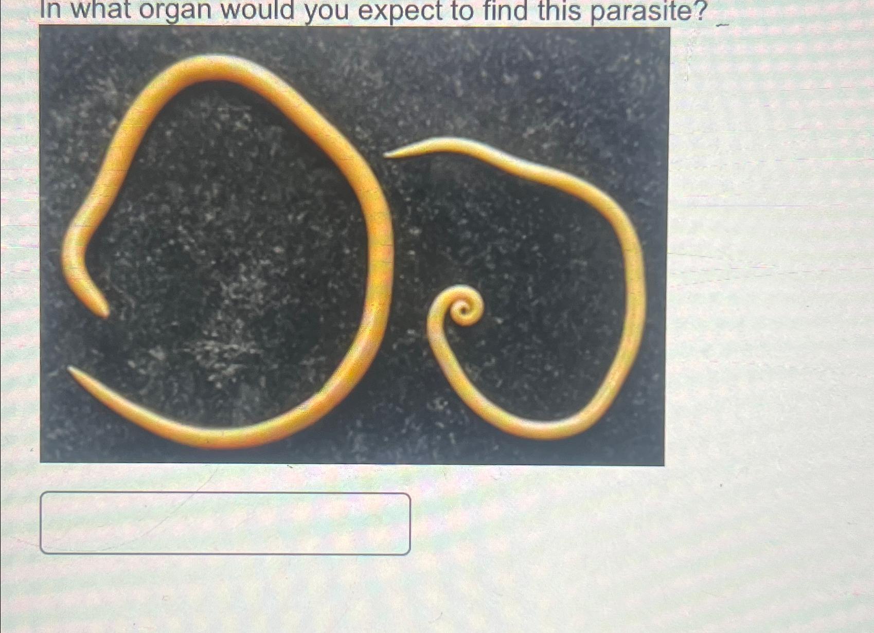 Solved In what organ would you expect to find this parasite? | Chegg.com