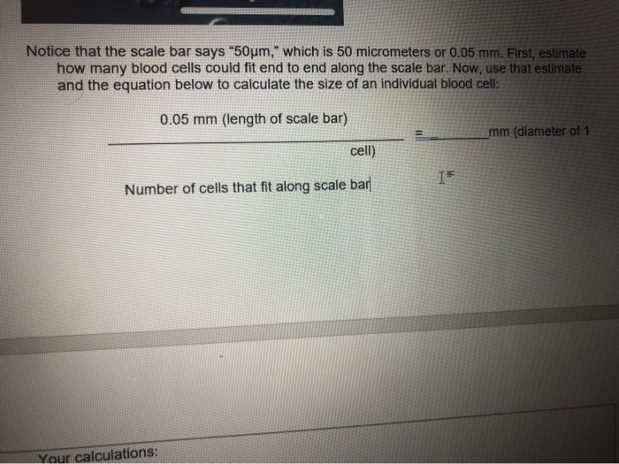 Notice that the scale bar says "50um," which is 50 | Chegg.com