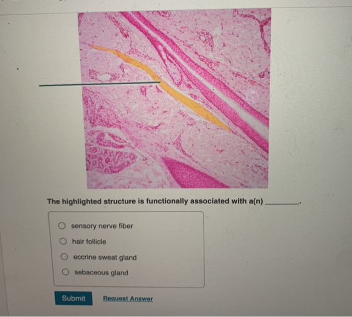 Solved The highlighted structure is functionally associated | Chegg.com