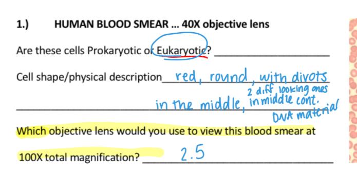 Solved 1.) ﻿HUMAN BLOOD SMEAR ... 40X objective lensAre | Chegg.com