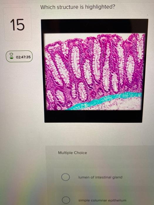 Solved Which structure is highlighted? 15 8 02:47:35 | Chegg.com