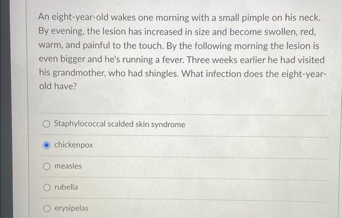 Solved The basic reproduction number (RO) of a pathogen is a | Chegg.com