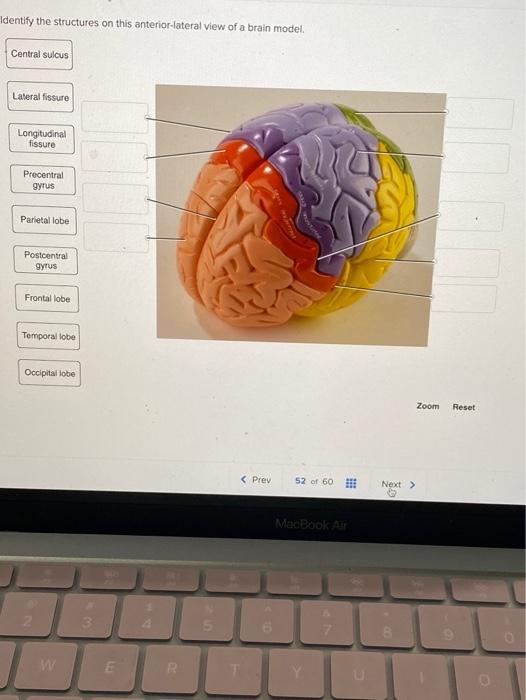 Solved saved Identify the structures on this midsagittal | Chegg.com