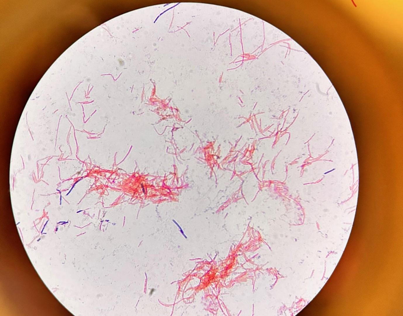 Solved Identification of unknown bacteria ,by morphology and | Chegg.com