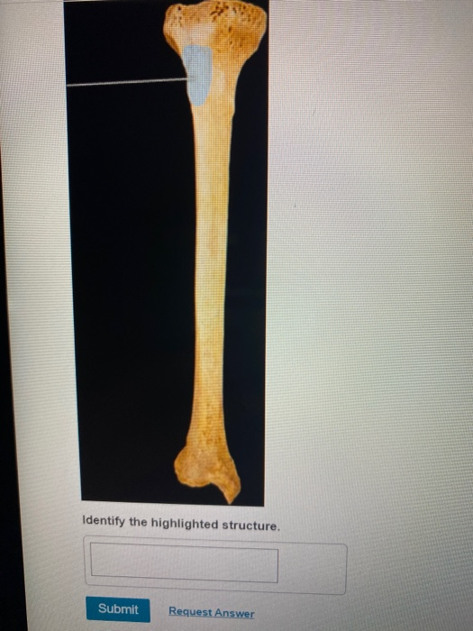 Solved Identify the highlighted structure. Submit Request | Chegg.com