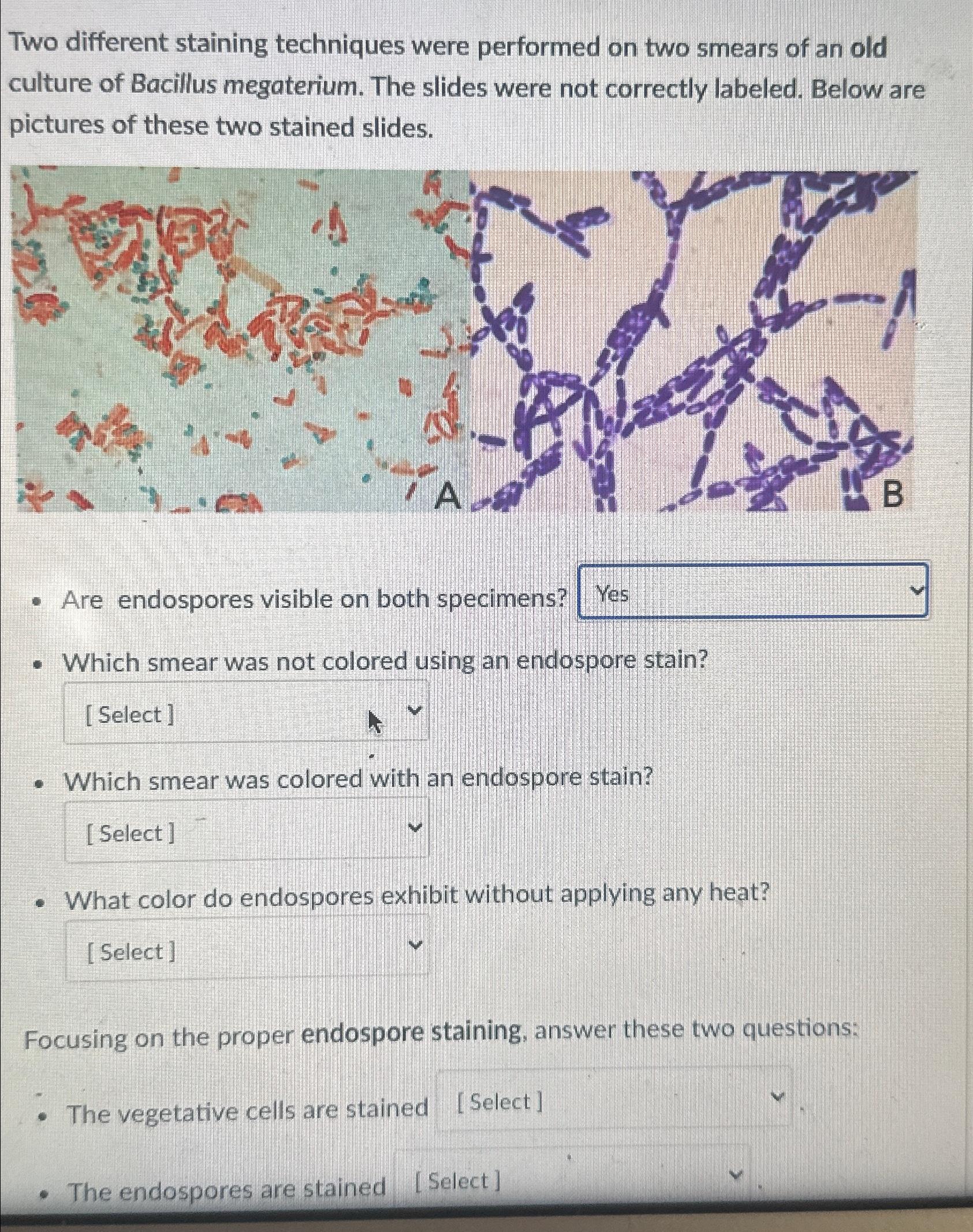 Solved Two different staining techniques were performed on | Chegg.com