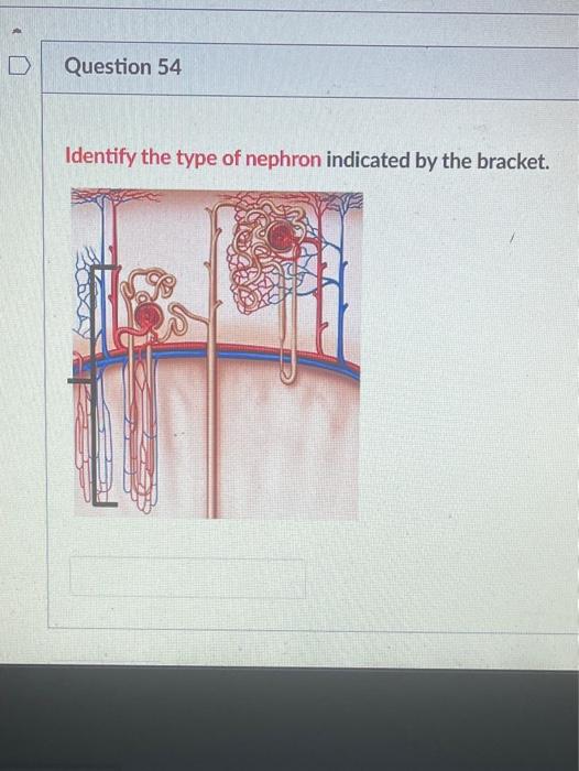 Solved Question 54 Identify the type of nephron indicated by | Chegg.com Solved Question 54 Identify the type of nephron indicated by | Chegg.com