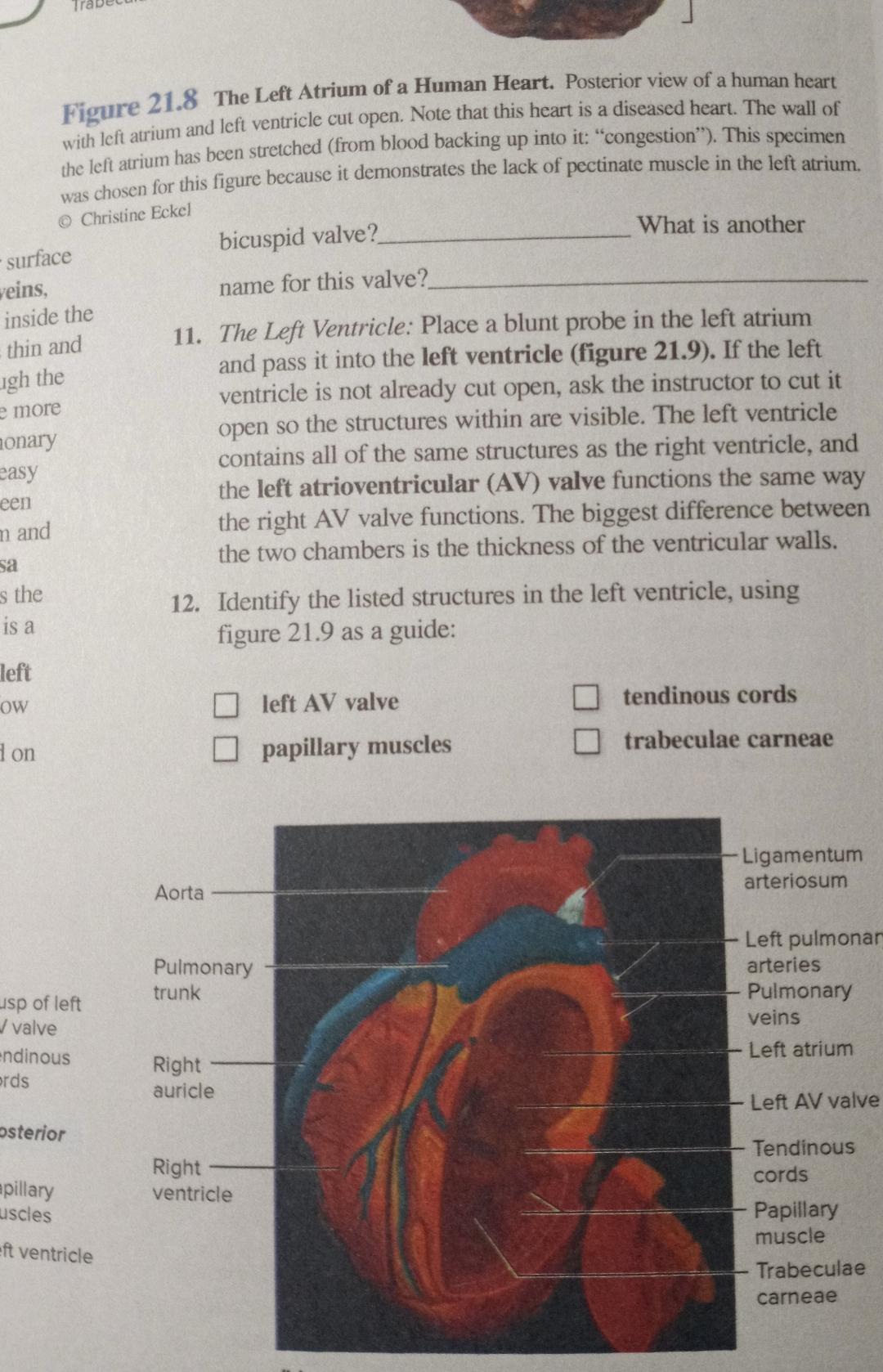 Solved Figure 21.8 ﻿The Left Atrium of a Human Heart. | Chegg.com