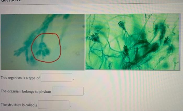 Solved This organism is a type of The organism belongs to | Chegg.com