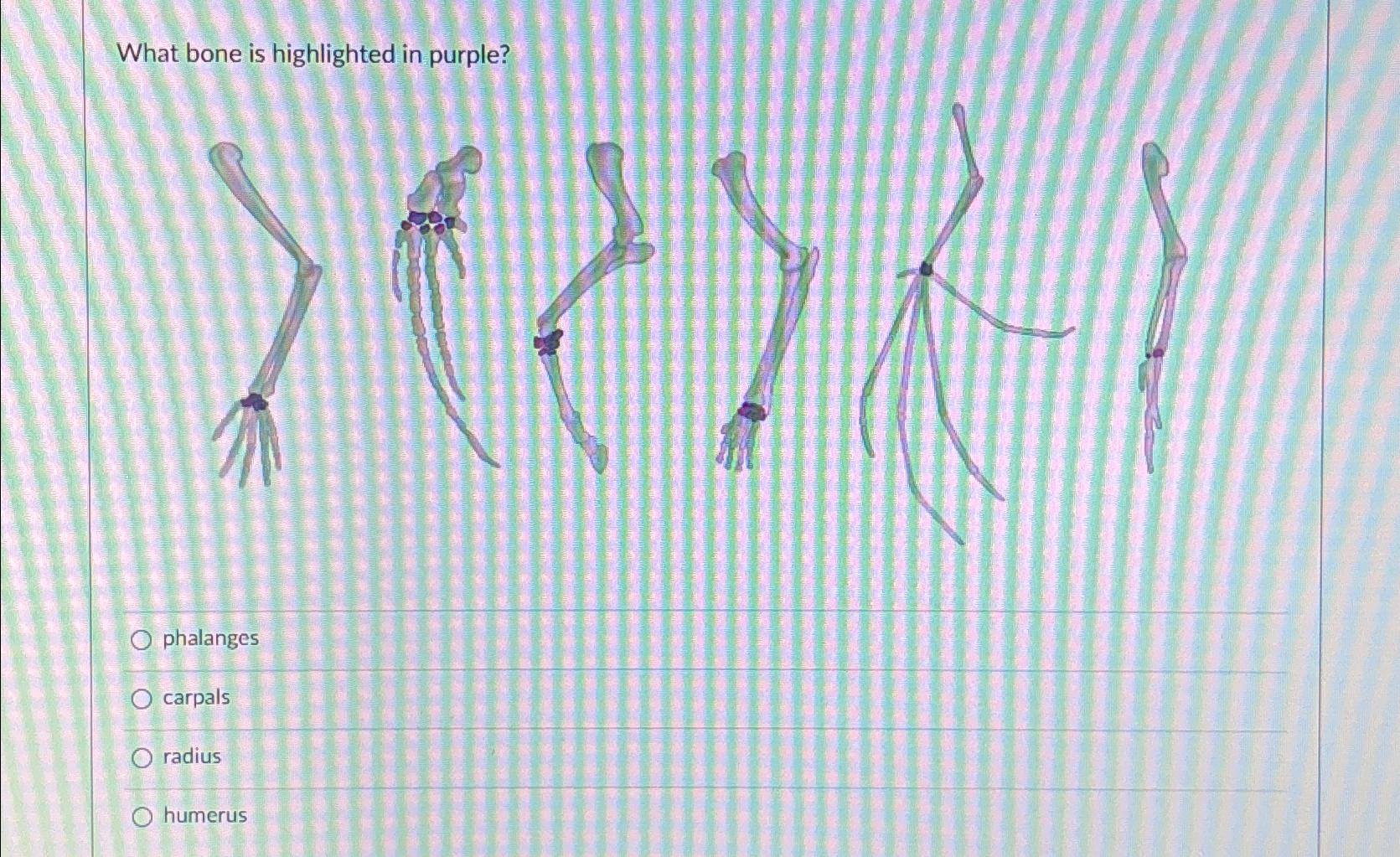 Solved What bone is highlighted in | Chegg.com