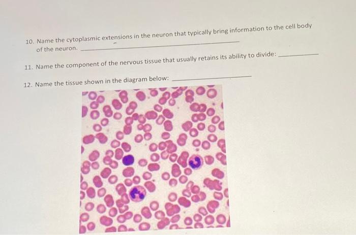Solved 10. Name the cytoplasmic extensions in the neuron | Chegg.com