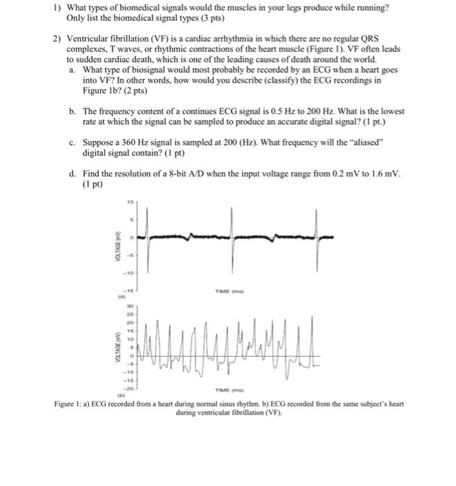 Solved 1) What types of biomedical signals would the muscles | Chegg.com