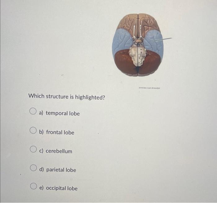 Solved Which structure is highlighted? a) temporal lobe b) | Chegg.com