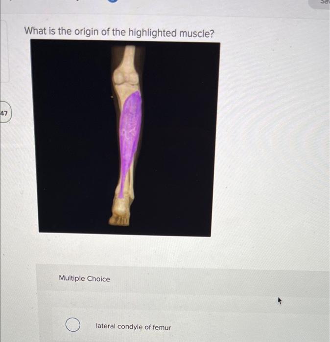 Solved 47 What is the origin of the highlighted muscle? 710 | Chegg.com