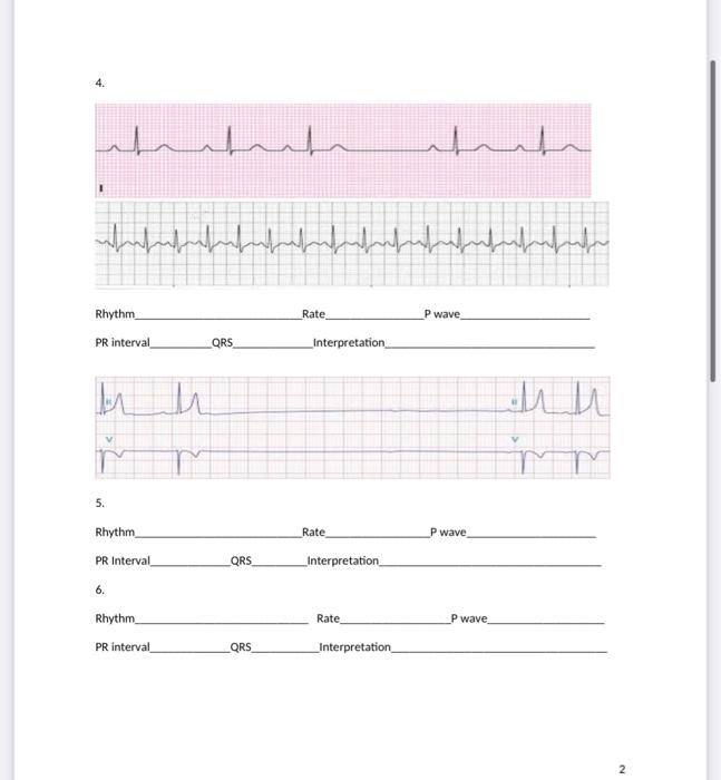 2. Rhythm Rate P wave PR interval QRS Interpretation. | Chegg.com