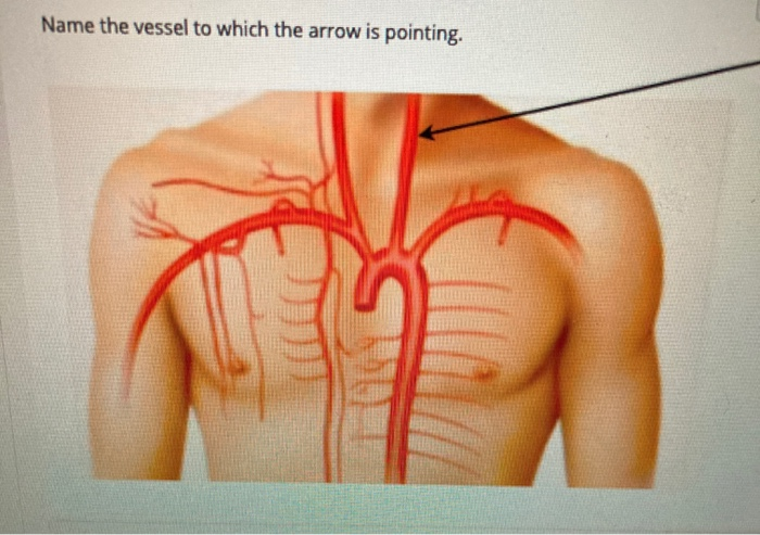 Solved Name the vessel to which the arrow is pointing. | Chegg.com