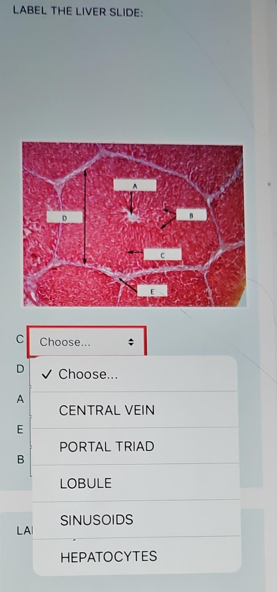Solved LABEL THE LIVER SLIDE: | Chegg.com