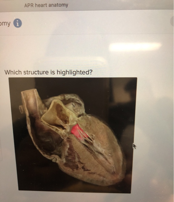 APR heart anatomy my Which structure is highlighted? | Chegg.com