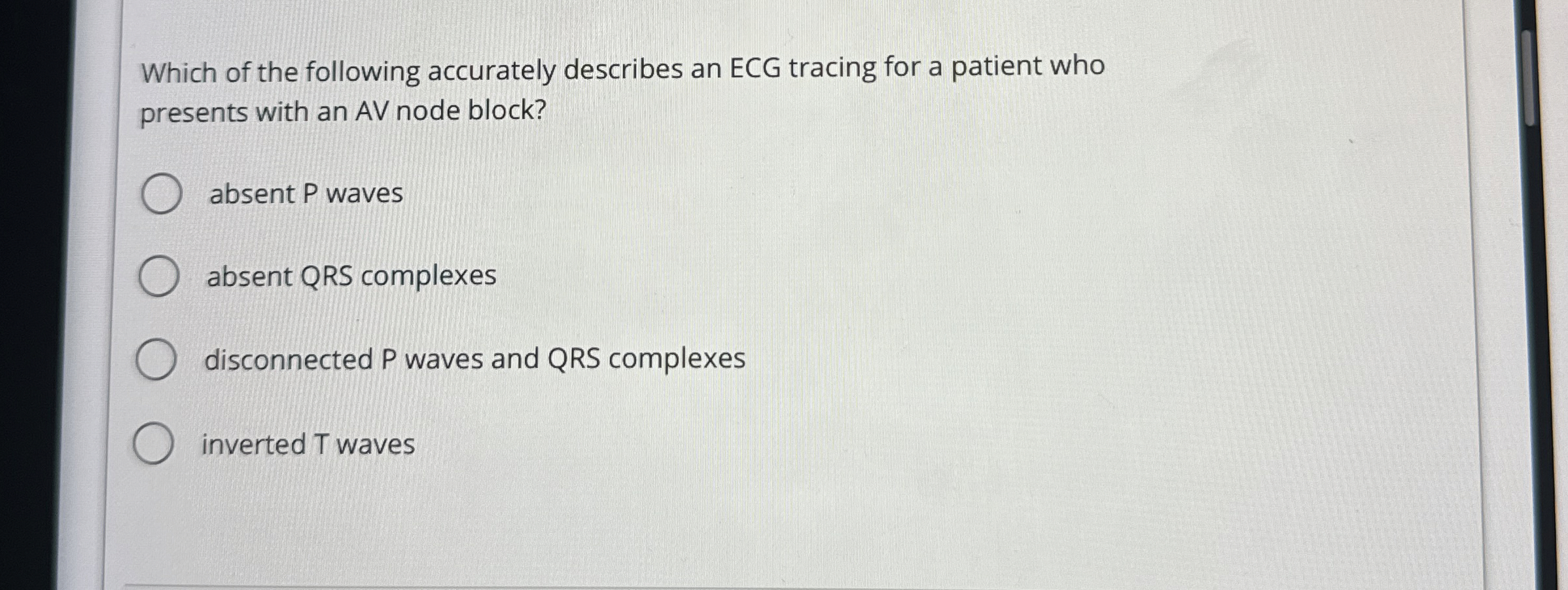 Solved Which of the following accurately describes an ECG | Chegg.com
