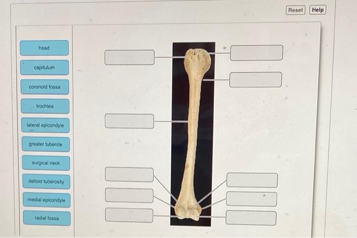 Solved Reset Help head capitulum coronoid fossa trochlea | Chegg.com