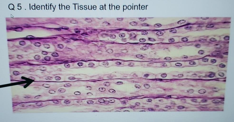 Solved Q5. Identify the Tissue at the pointer | Chegg.com