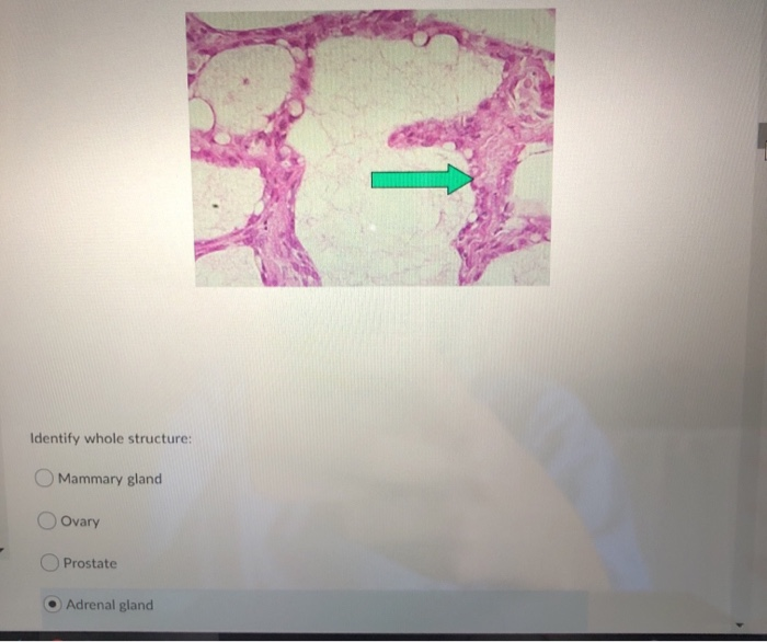 Solved Identify whole structure: Mammary gland Ovary | Chegg.com