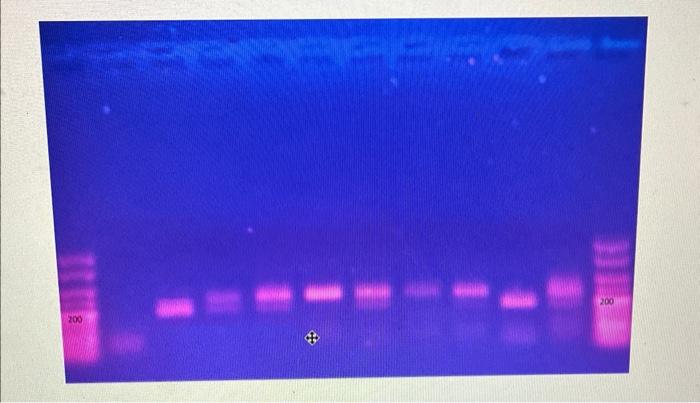 Solved What are the genotypes in this electropheresis gel? | Chegg.com