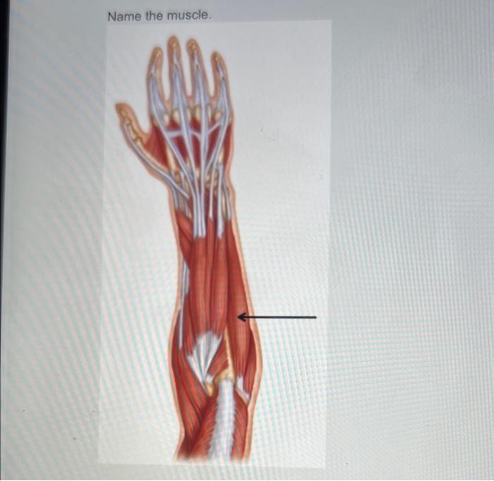 Solved Name the muscle. | Chegg.com