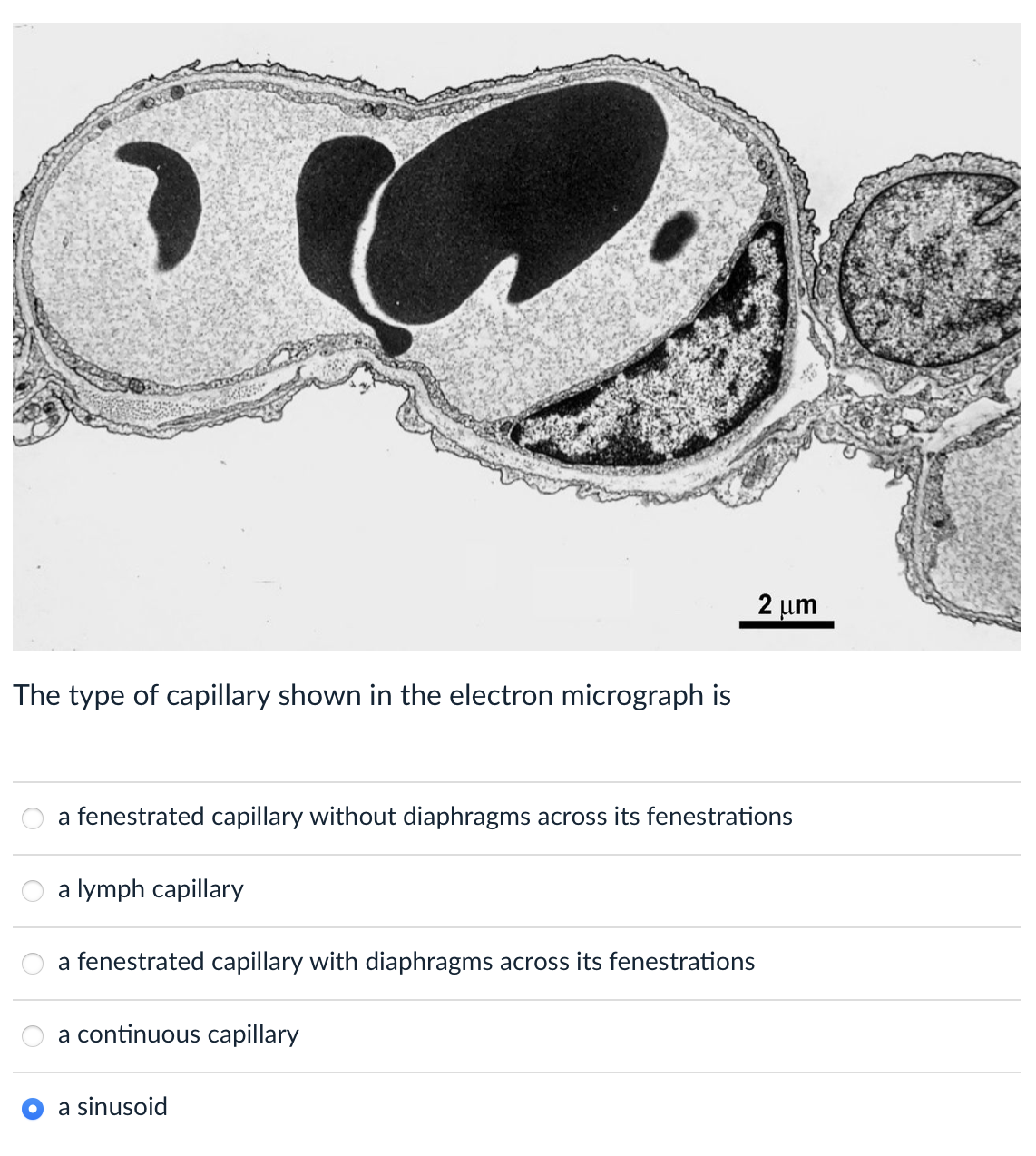Solved The type of capillary shown in the electron | Chegg.com