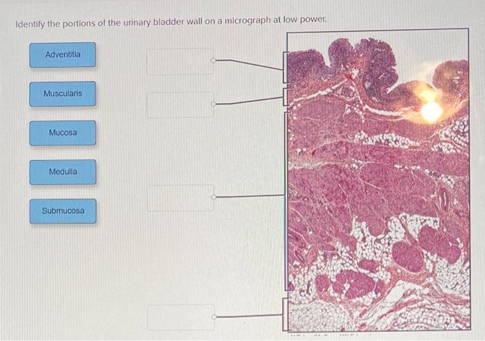Solved Identify the portions of the urinary bladder wall on | Chegg.com