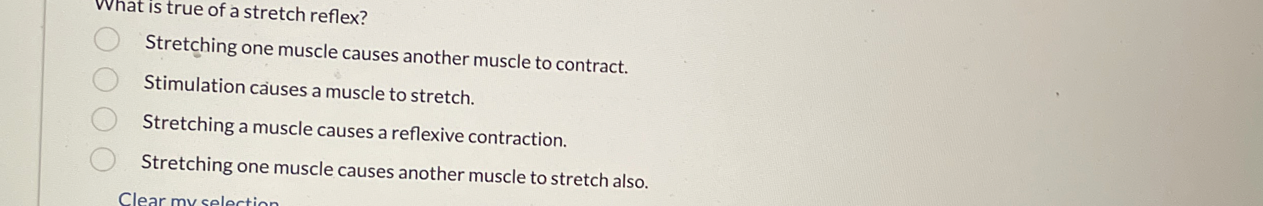 Solved What is true of a stretch reflex?Stretching one | Chegg.com