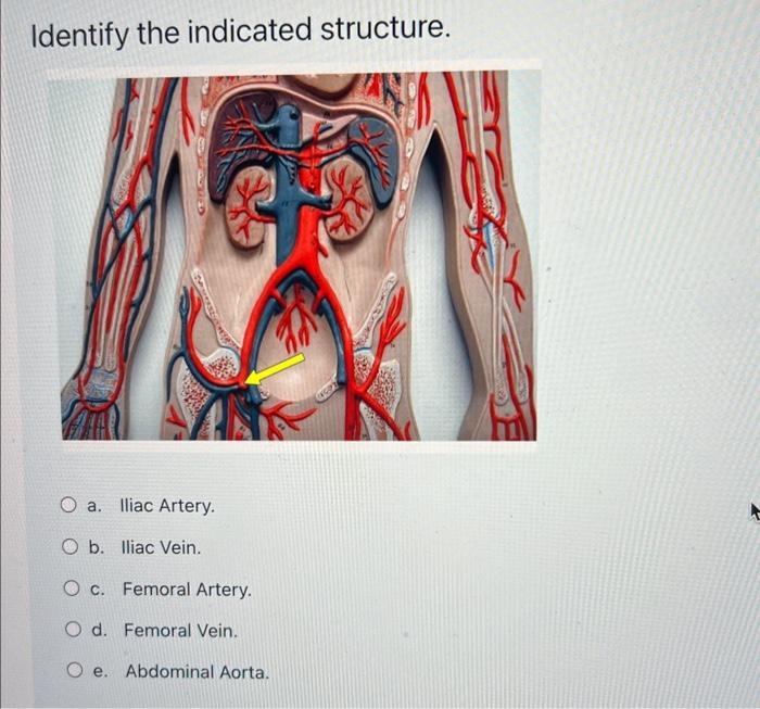 Solved Identify the indicated structure. a. Iliac Artery. b. | Chegg.com