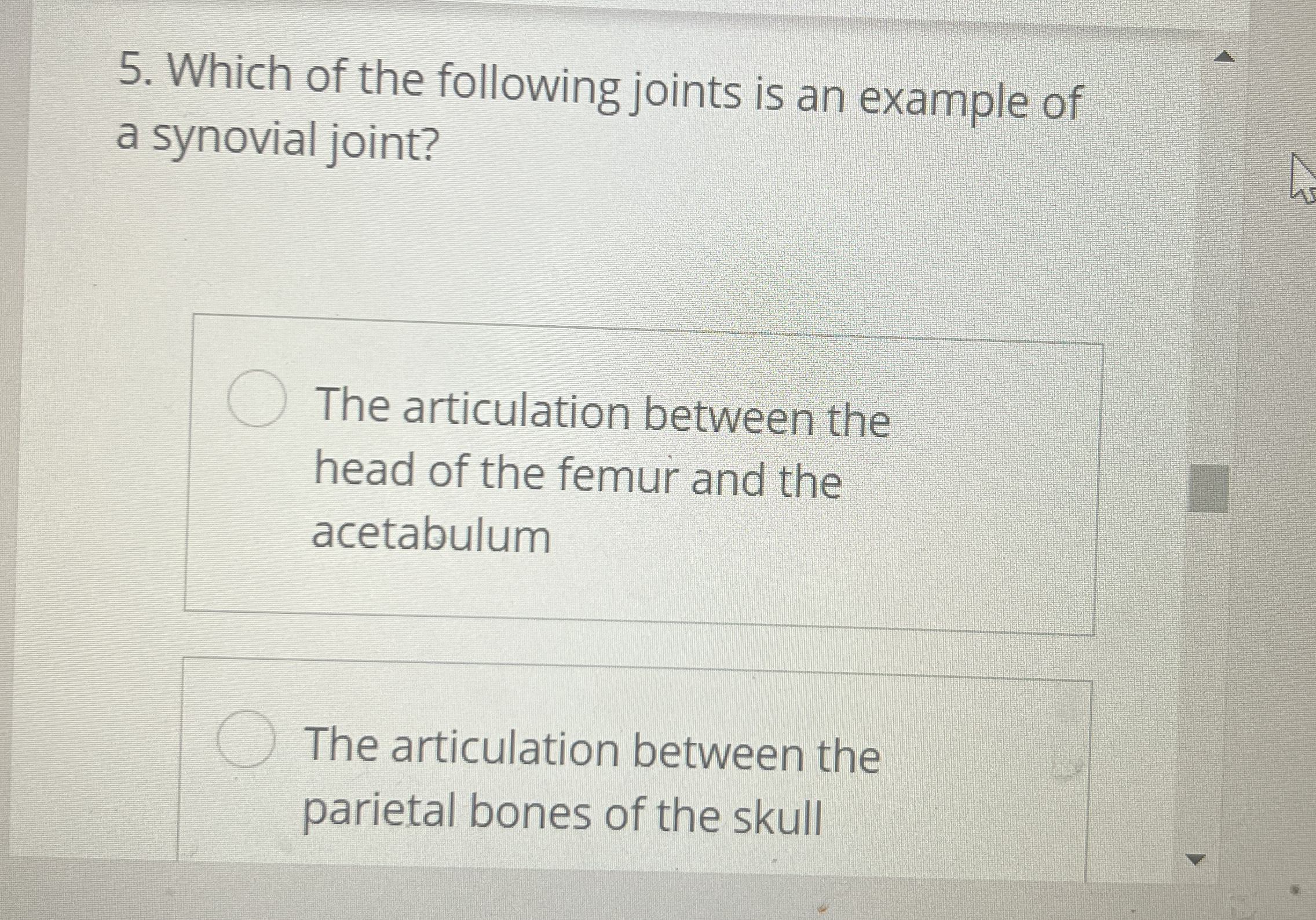 Solved Which of the following joints is an example ofa | Chegg.com