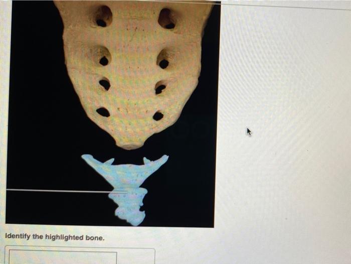 Solved Identify the highlighted bone. Identify the | Chegg.com