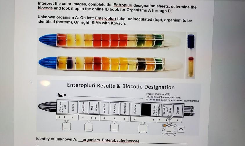 Solved Unknown organism B: On left: Enteropluri tube: | Chegg.com