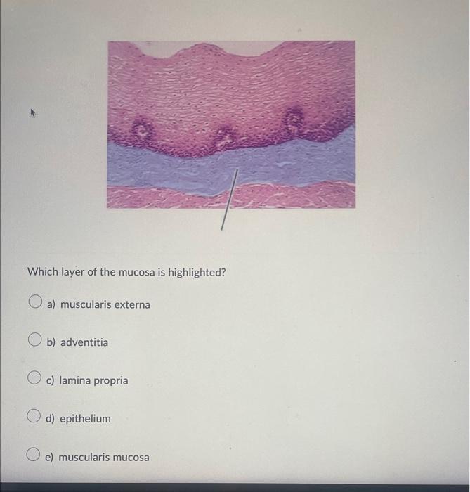 Solved Which layer of the mucosa is highlighted? a) | Chegg.com