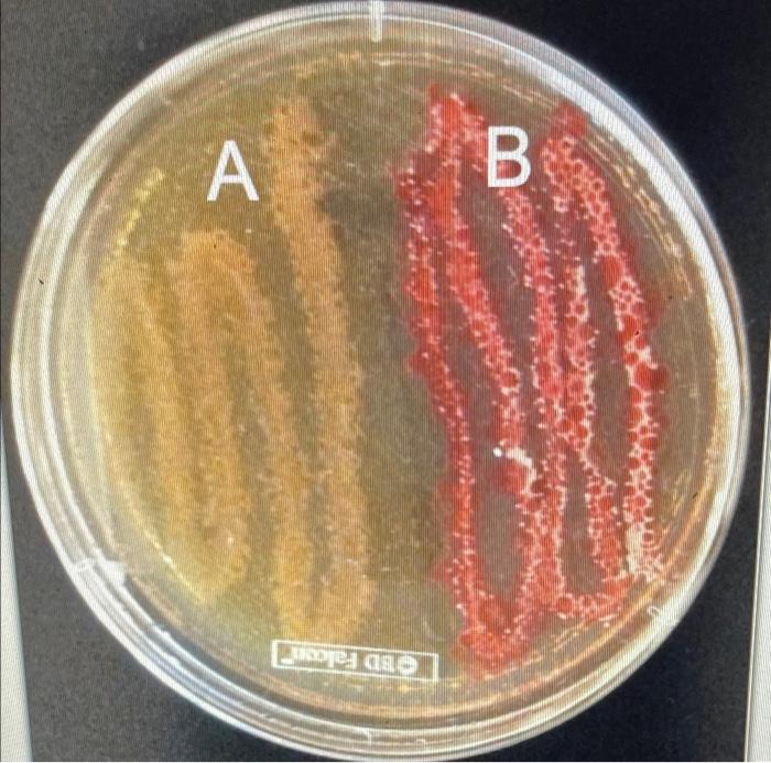 Solved which zone is positive on this starch plate? what | Chegg.com