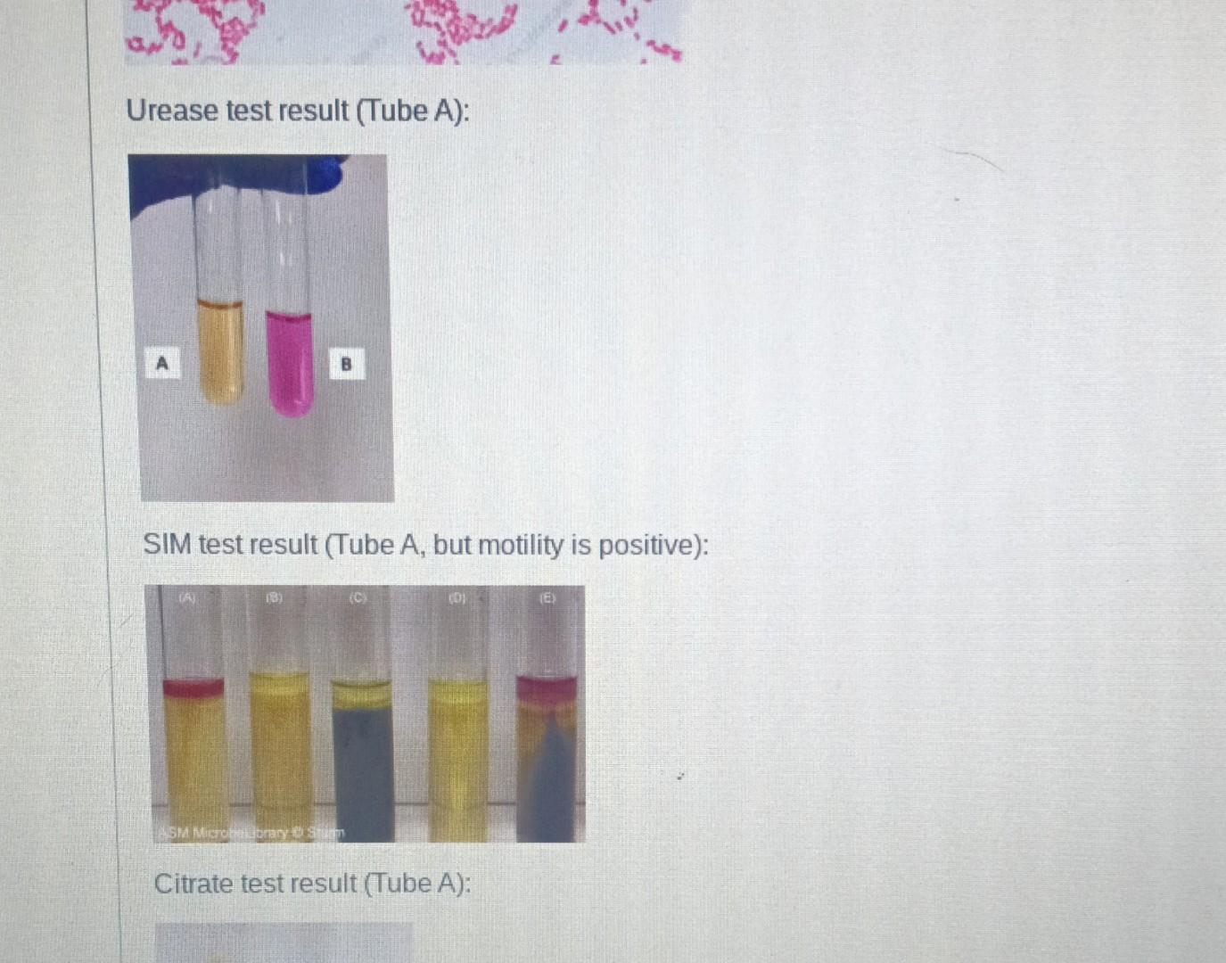 Solved You perform several tests on an unidentified | Chegg.com