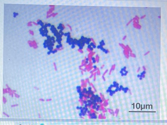 Solved 10um The above image shows gram staining (pink | Chegg.com
