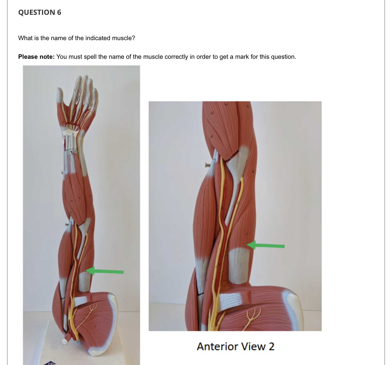 Solved Please note: You must spell the name of the muscle | Chegg.com